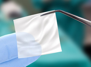 Amniotic and Placental Graft Tissue for Surgery and Wound Care Piedmont ...