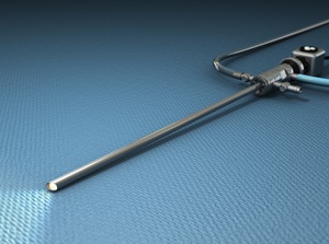 Arthroscopy (Overview) Piedmont Orthopedics | OrthoAtlanta