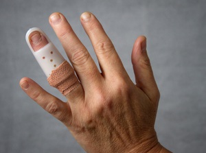 Finger Fracture Piedmont Orthopedics | OrthoAtlanta