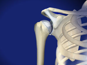 Shoulder Resurfacing Piedmont Orthopedics | OrthoAtlanta