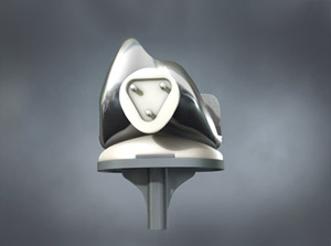 Total Knee Replacement Piedmont Orthopedics | OrthoAtlanta